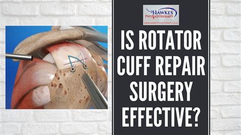 Image result for Rotator Cuff Repair Surgery
