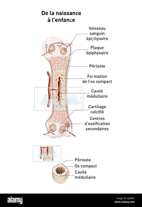 Image result for Types of Abnormal Bone Formation