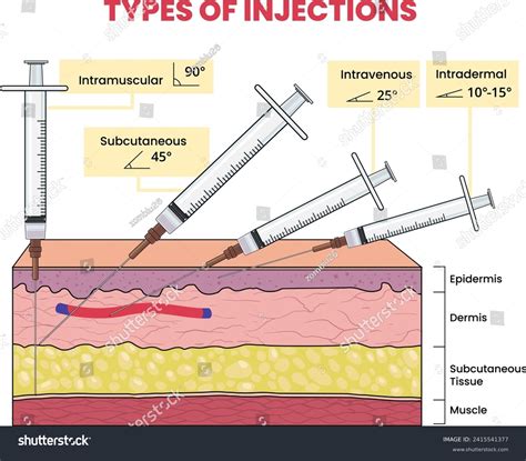 Image result for Different Types of Injection Pump