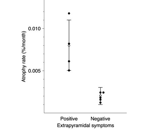 Image result for Extrapyramidal Signs