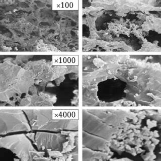 Image result for Magnification of Electron Microscope