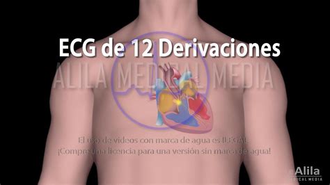 Image result for ECG 12 Derivaciones Normal