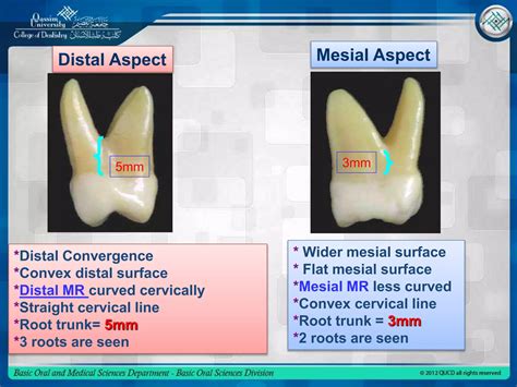 Image result for Maxillary First Molar