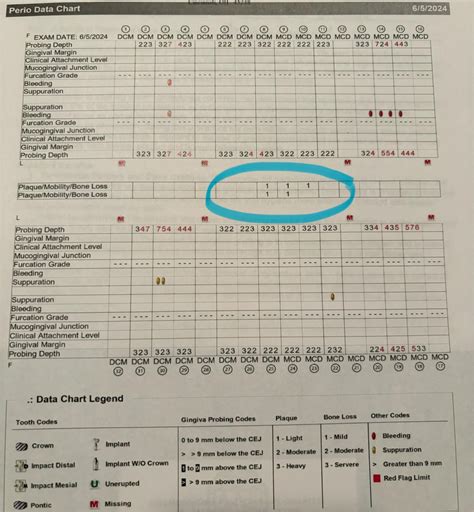 Image result for Paper Perio Chart