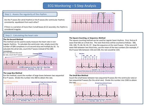 Image result for PR Interval ECG Boxes