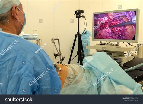 Image result for Endoscopy Operating Room