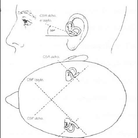 Image result for Retropulsion Test Procedure