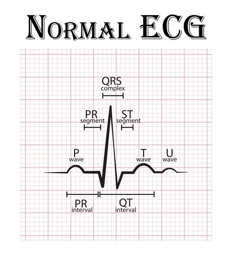 Image result for Normal ECG Range Chart