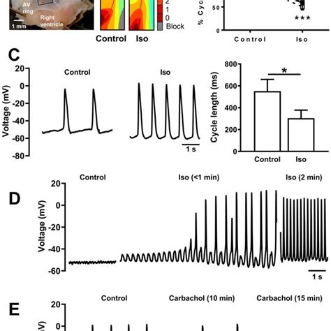 Image result for Pacemaker Potential