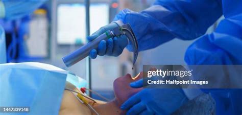 Image result for Surgery Intubation