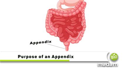 Image result for Appendix WHA Is It