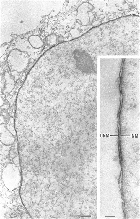 Image result for Nuclear Envelope Localization