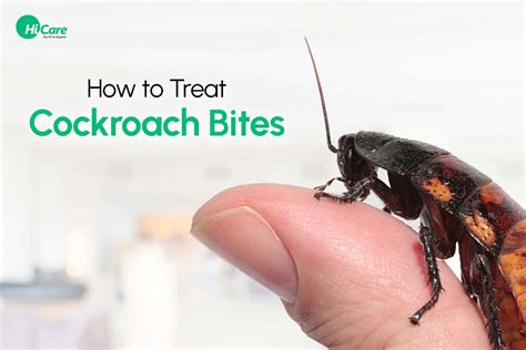 Image result for Cockroach Bites On Humans