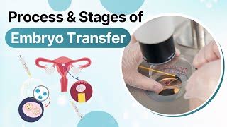 Image result for Watch Embryo Transfer