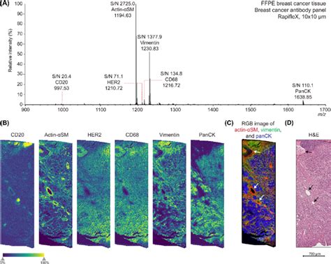 Image result for Tissue Microarray Multiplex IHC NCR