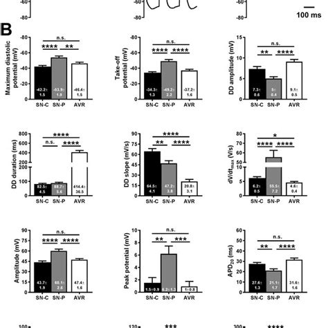 Image result for Pacemaker Potential