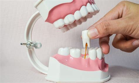 Image result for DIY Teeth Removal