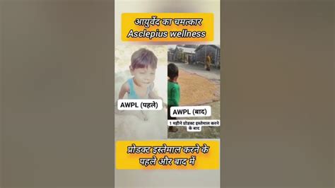 Image result for Awpl Result