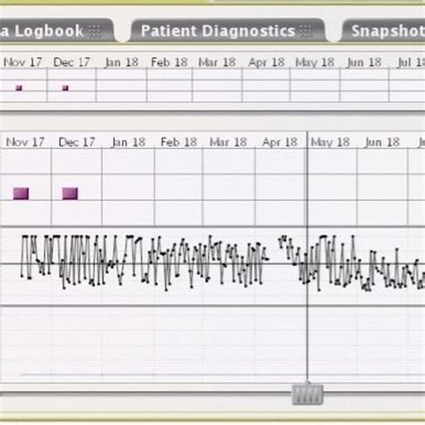 Image result for Scan RDI