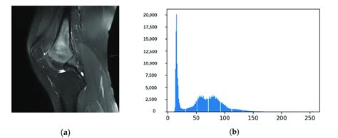 Image result for Frequency Distribution Histogram