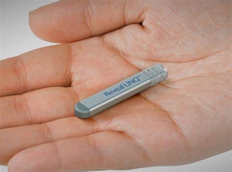 Image result for Loop Recorder Monitoring System