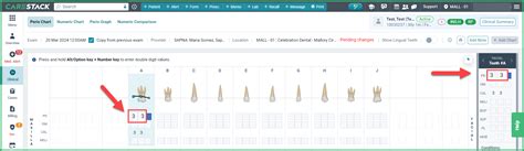 Image result for How to Perio Chart