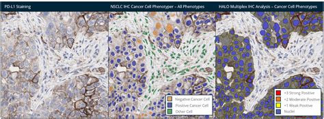 Image result for Tissue Microarray Multiplex IHC NCR