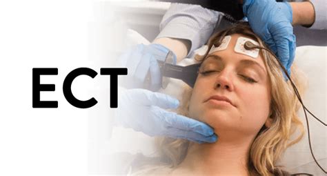 Image result for Collection Ect