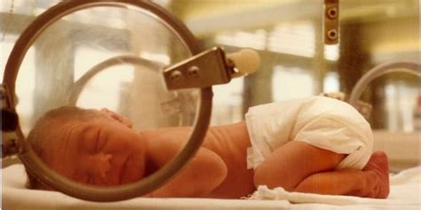 Image result for Neonatal Intubation