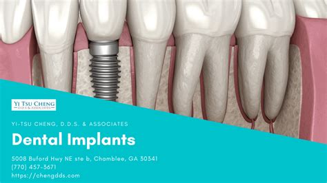 Image result for Infected Wisdom Tooth Extraction