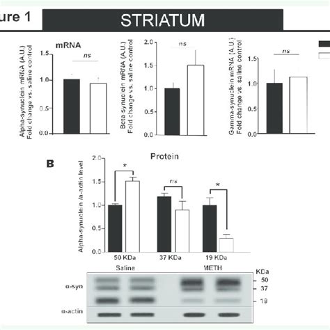 Image result for Mouse Brain Dissection