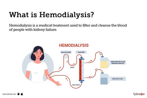 Image result for Dialysis Explained