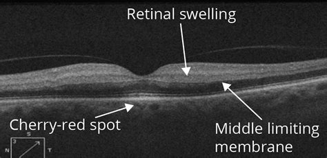 Image result for Oct Check