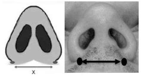 Image result for Alar Guide