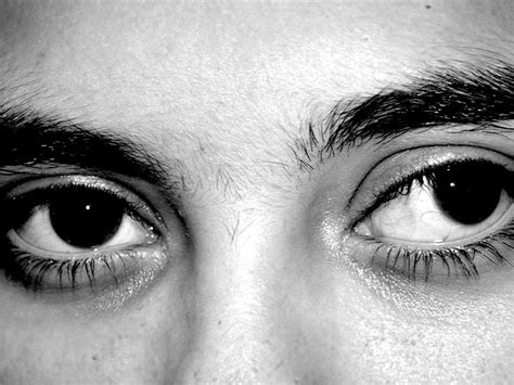 Image result for Exotropia and Computer