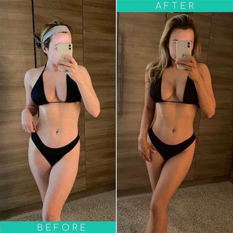 Image result for Body Contouring Boo
