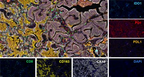 Image result for Tissue Microarray Multiplex IHC NCR