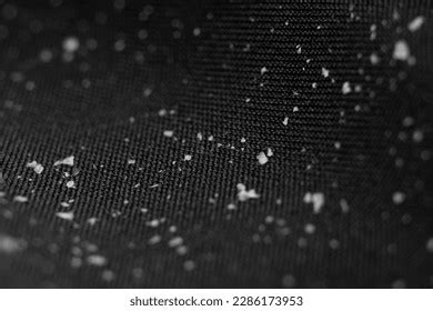 Image result for Seborrheic Dermatitis Contagious