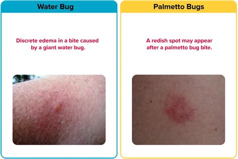 Palmetto Bug Vs. Water Bug [15 Differences] | APB