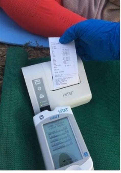 Image result for Istat ABG Machine