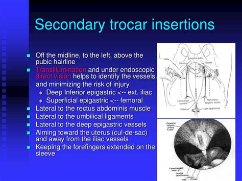 Image result for Versa Step System