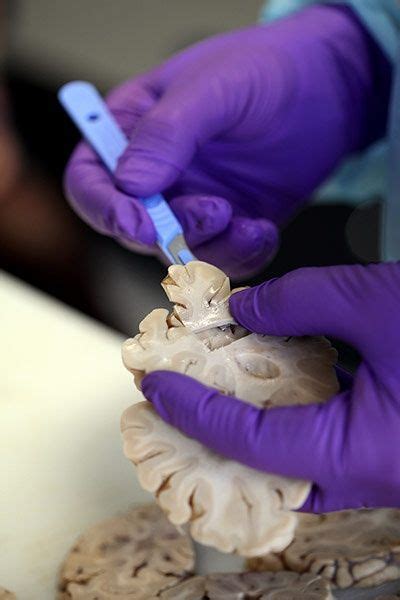 Image result for Human Brain Dissection