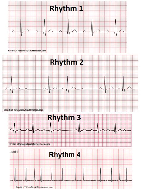 Image result for ECG Reading Practice