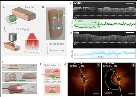 Image result for Oct Check