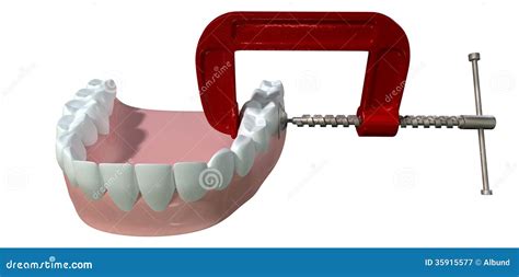 Image result for Tooth Extraction Clamp