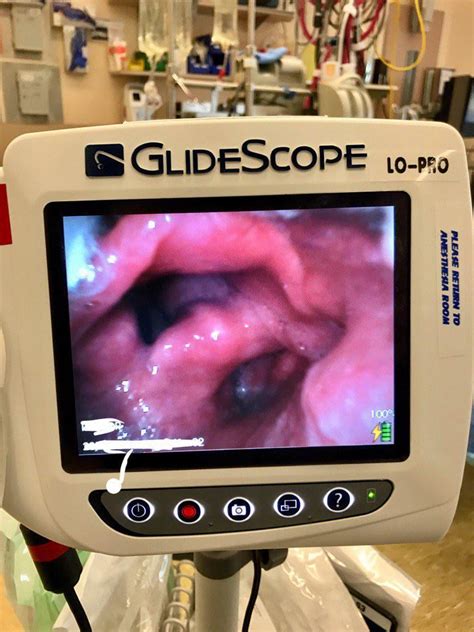 Image result for Intubate