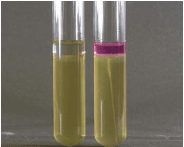 Image result for Indole Test Procedure