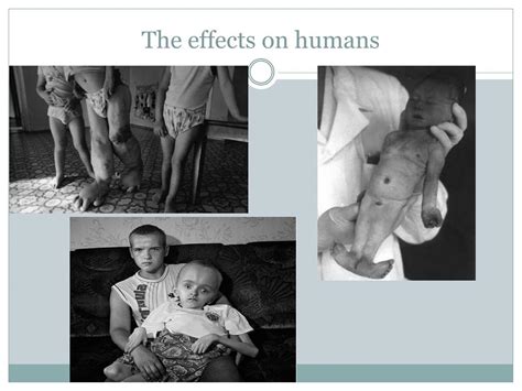 Image result for Chernobyl Disaster Human