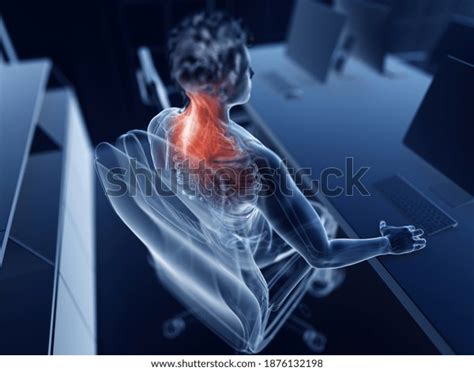 Image result for Computer Neck Pain