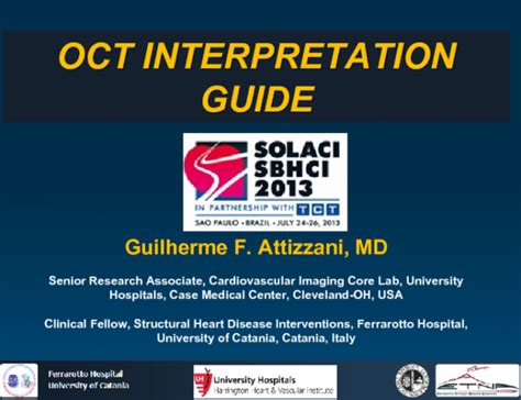 Image result for Oct Interpretation Guide